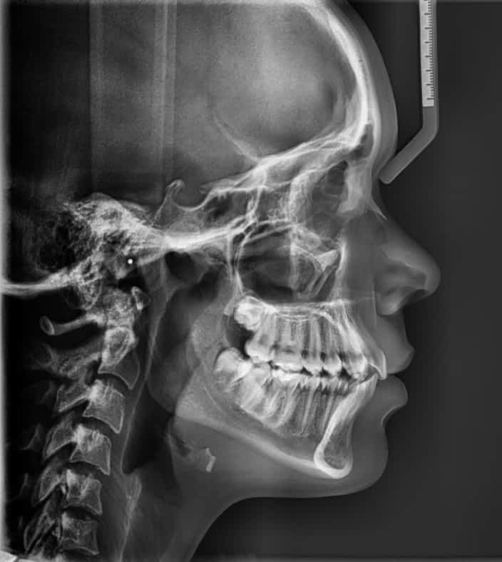 Telerradiografia Digital – Oral Face